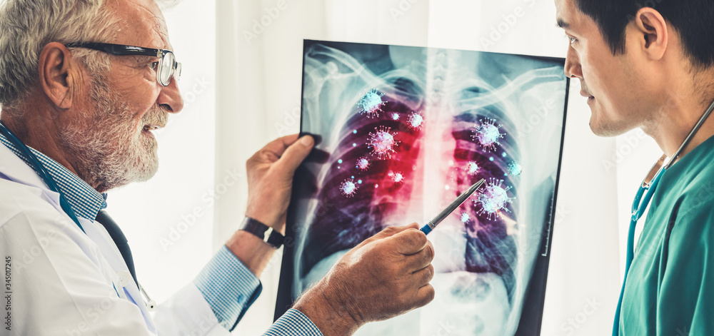 Doctor analyze Coronavirus Disease 2019 or Covid-19 displayed on x ray ...