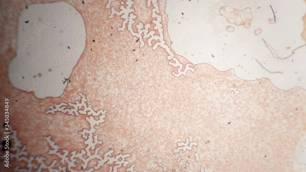 Fresh blood seen on a 40x microscope view. Blood smear under microscope ...