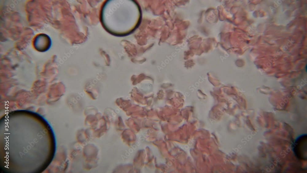 Fresh blood seen on a 1000x microscope view. Blood smear under ...