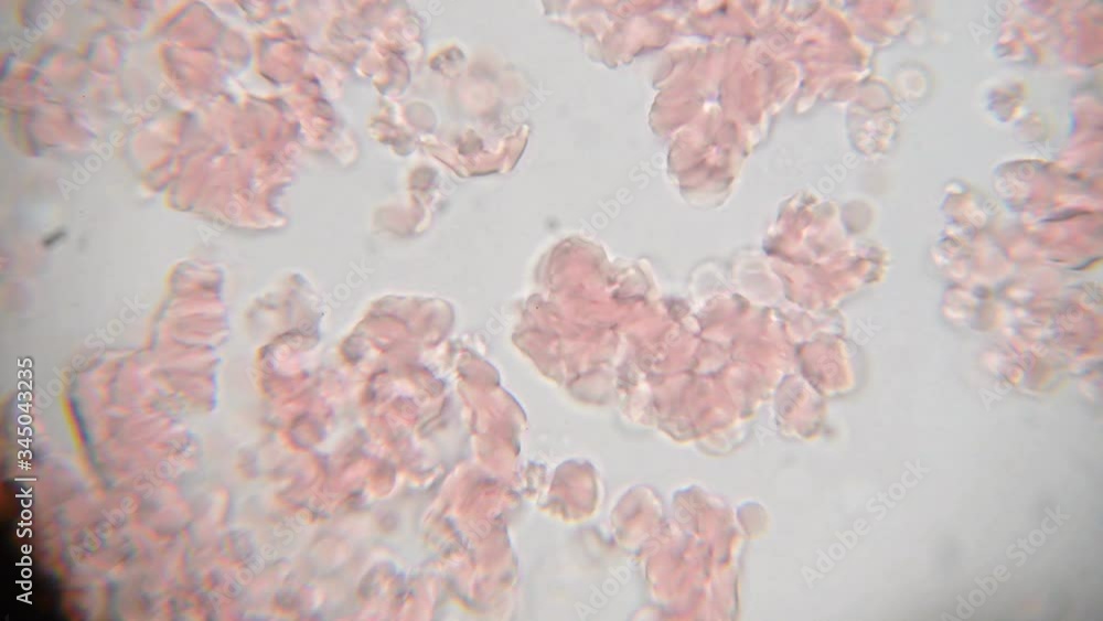 Video „Fresh blood seen on a 1000x microscope view. Blood smear under ...