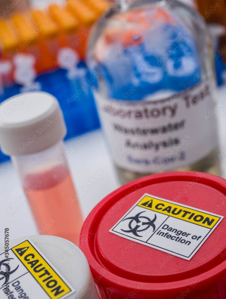 Scientific analysis of wastewater sample in laboratory, investigation ...