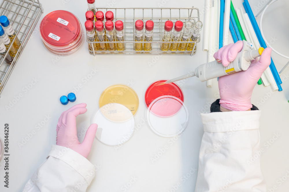 sample is applied with pipette to an agar plate in a microbiology ...