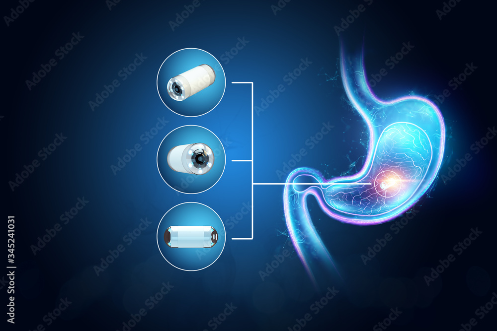 Doctor against the background of a hologram of the stomach, A camera ...