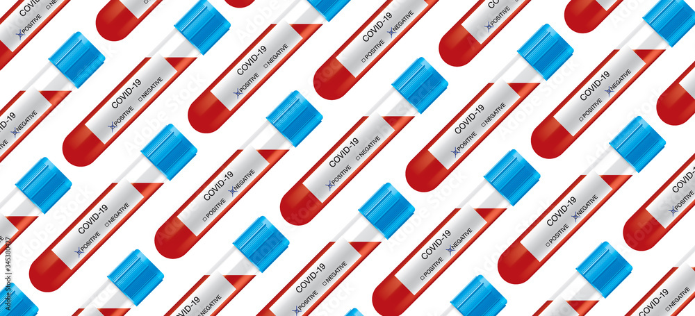 COVID-19 blood test tubes pattern. Laboratory glass capsules with white ...
