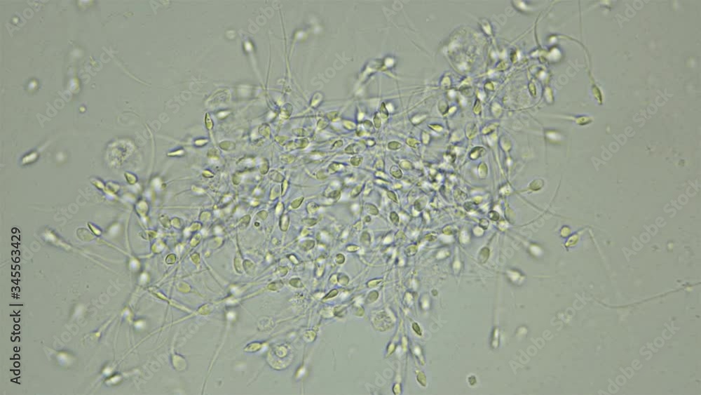 Human sperm under a microscope (spermatozoa), In the video, sperm ...