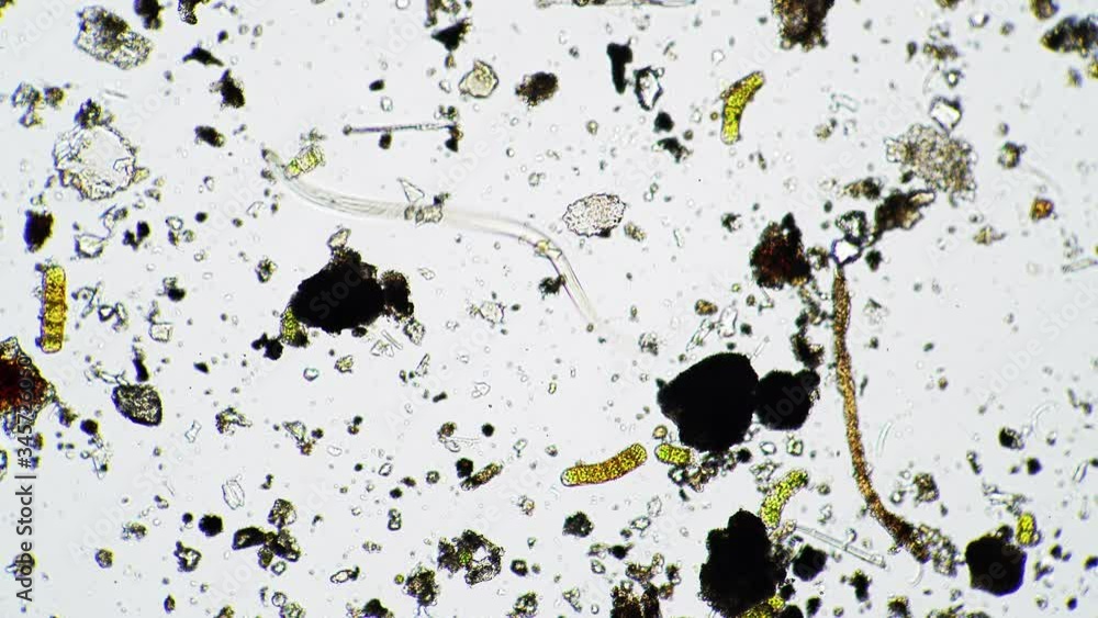 A large nematode worm moves in dirty water close up under a microscope ...