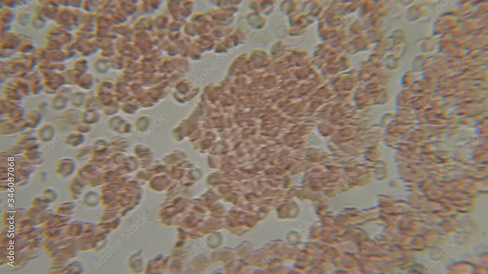 Human Blood, Diseases, Interstitial Fluid, Bacterial Background ...