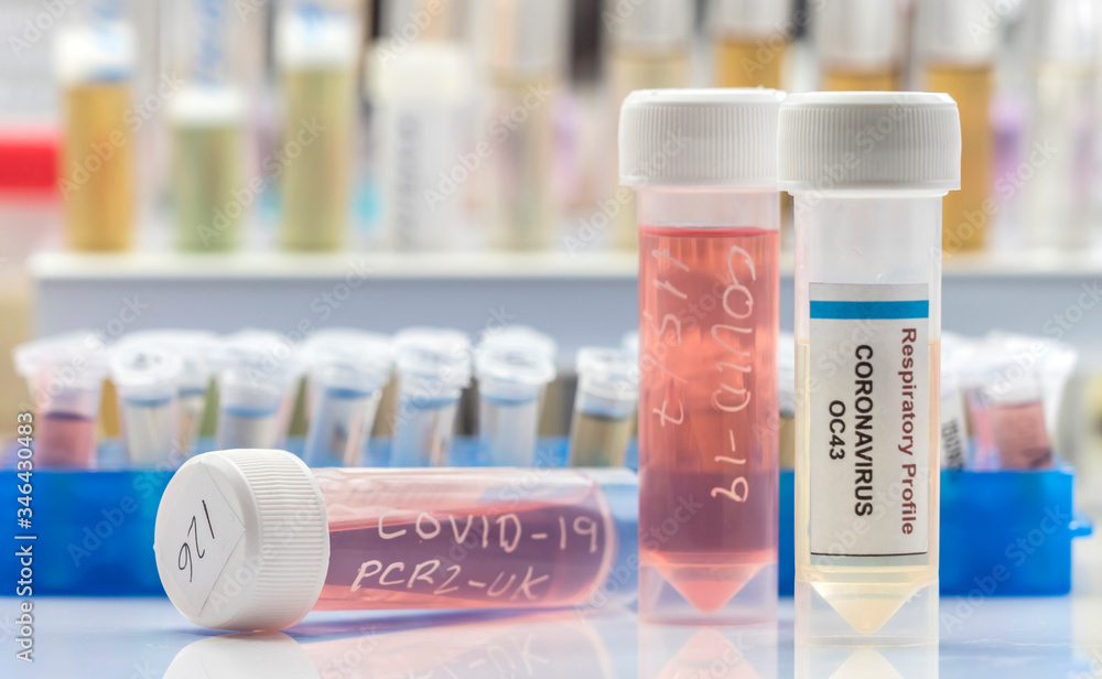 Vials with samples of SARS-COV-2 Covid-19 in a research laboratory ...