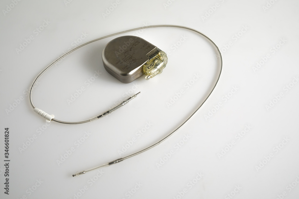 An Implantable Cardioverter Defibrillator or ICD pacemaker with leads ...