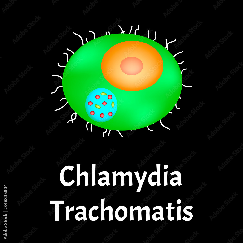 Chlamydia trachomatis. Bacterial infections Chlamydiosis. Sexually ...