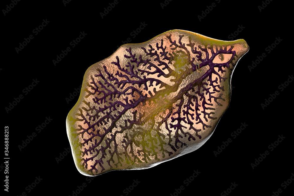 Fasciola Hepatica In Liver
