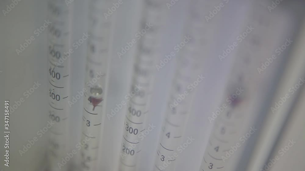 ALV apparatuses, alv, Ecg Monitor Patient's Condition, Artificial heart ...