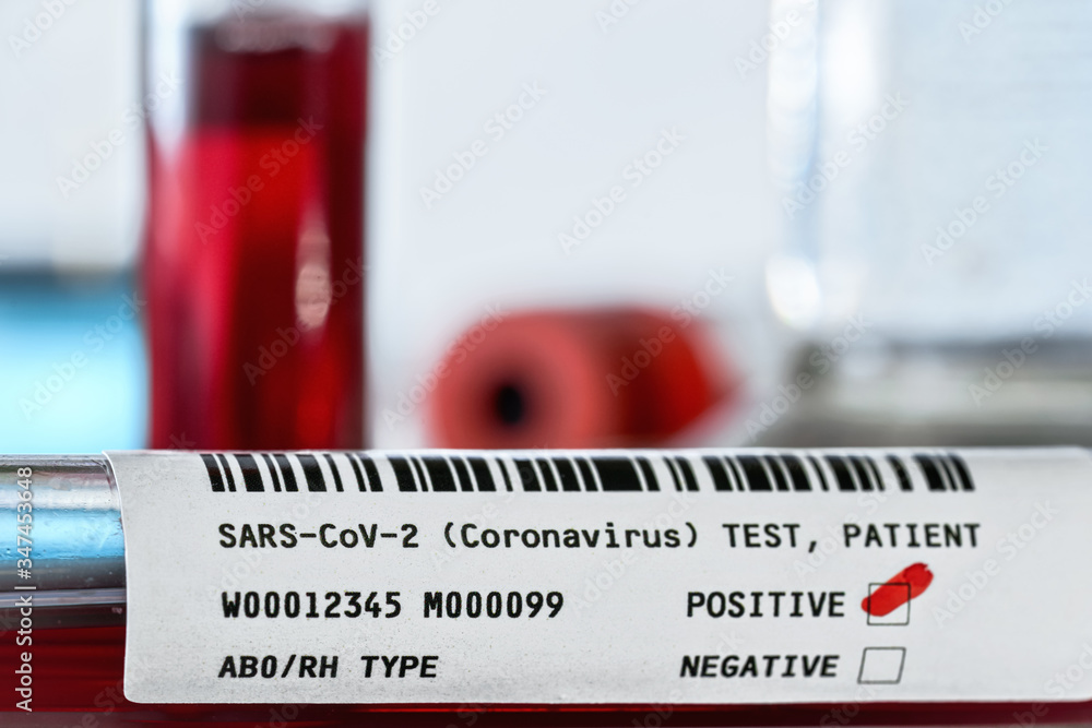 Sample vial with blood, label (own design, dummy barcode & data ...