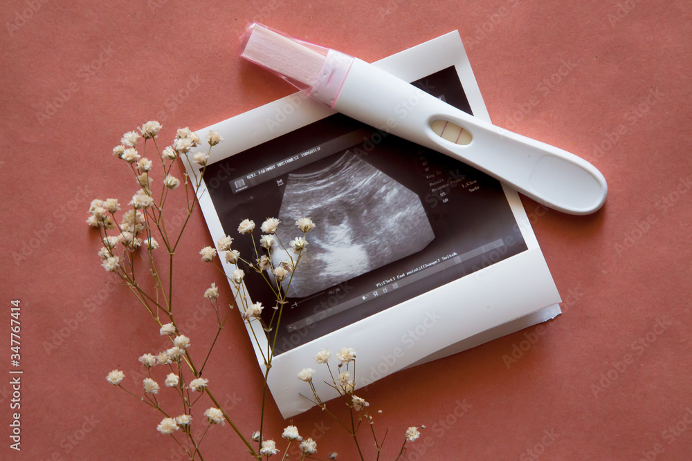 Ultrasound scan of an unborn baby of fifth week with a pregnancy test ...