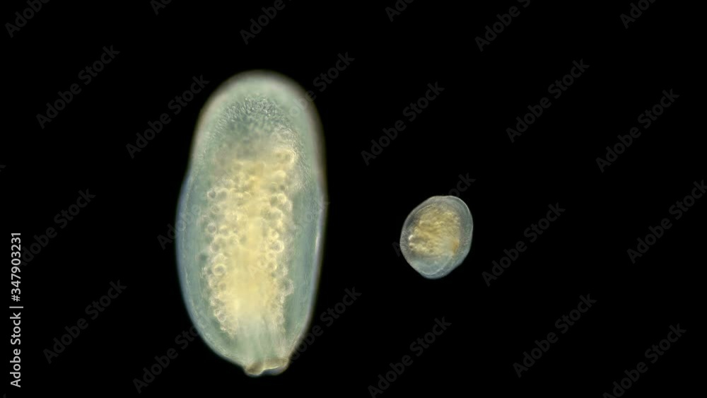 coral larva under a microscope, Order: Actiniaria, Phylum: Cnidaria ...