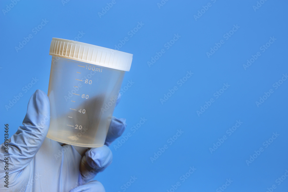 A nurse, doctor holds an Empty Urine container with a lid on a blue ...