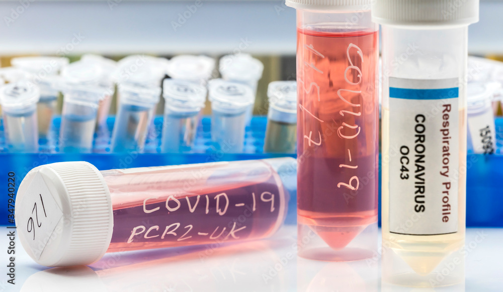 Vials with samples of SARS-COV-2 Covid-19 in a research laboratory ...