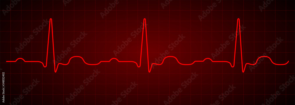 Heartbeat line. Red electrocardiogram. Vector pulse line. Medical ...