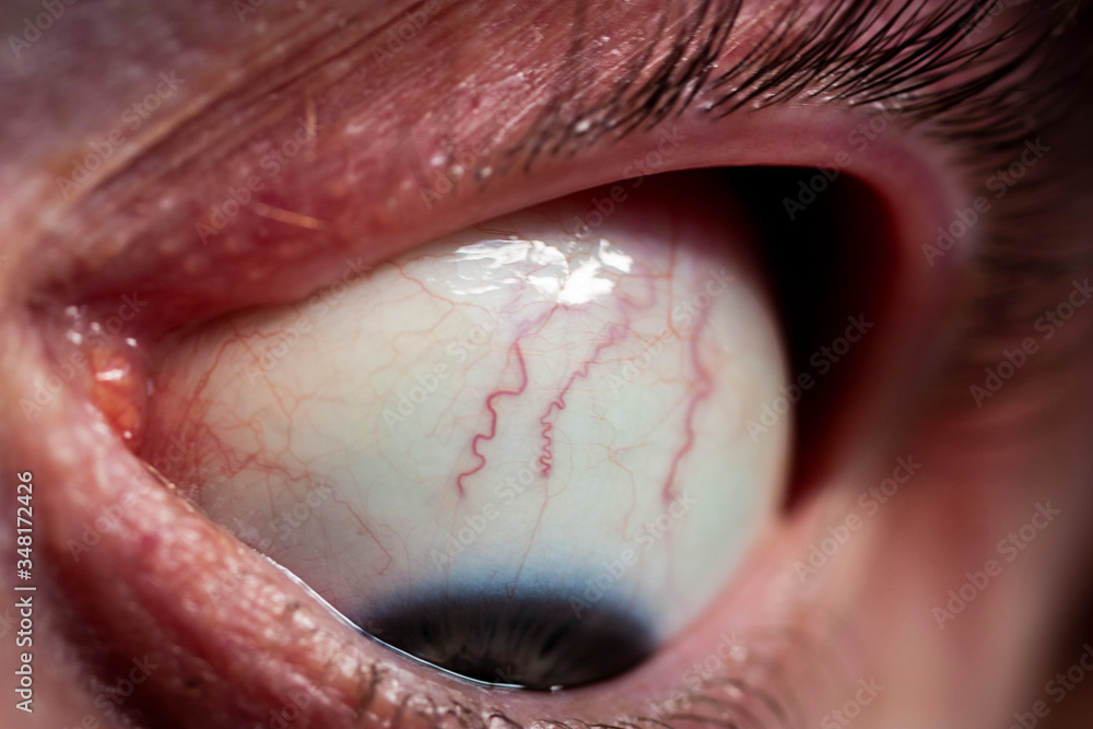 eye ball looking down Stock Photo | Adobe Stock