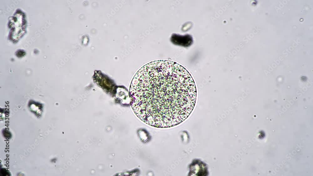Round multicellular protozoan animal under a microscope. Round cover of ...