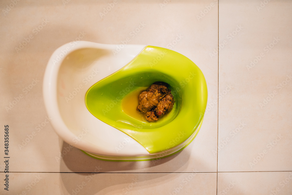 Poop of a baby inside the infant potty. ภาพถ่ายสต็อก | Adobe Stock