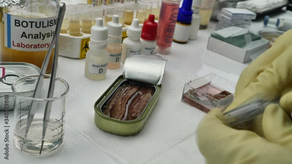 Experienced laboratory scientist analyzing a fecal sample, botulism ...