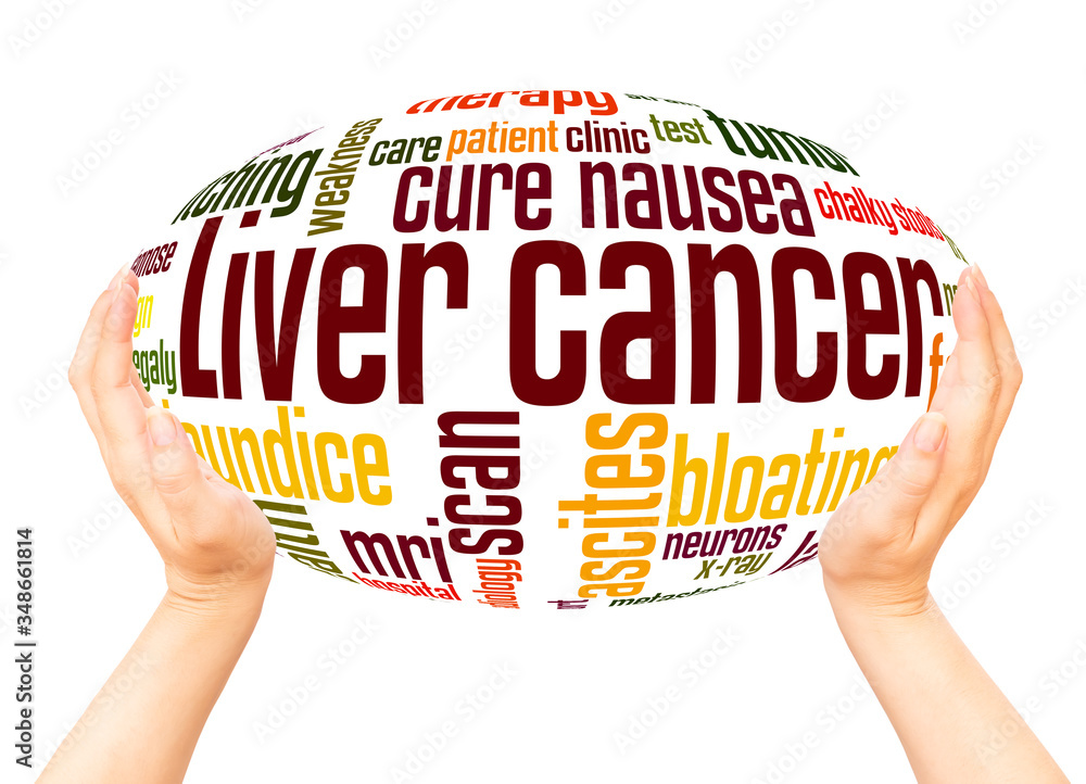 Liver cancer word hand sphere cloud concept Stock Illustration | Adobe ...
