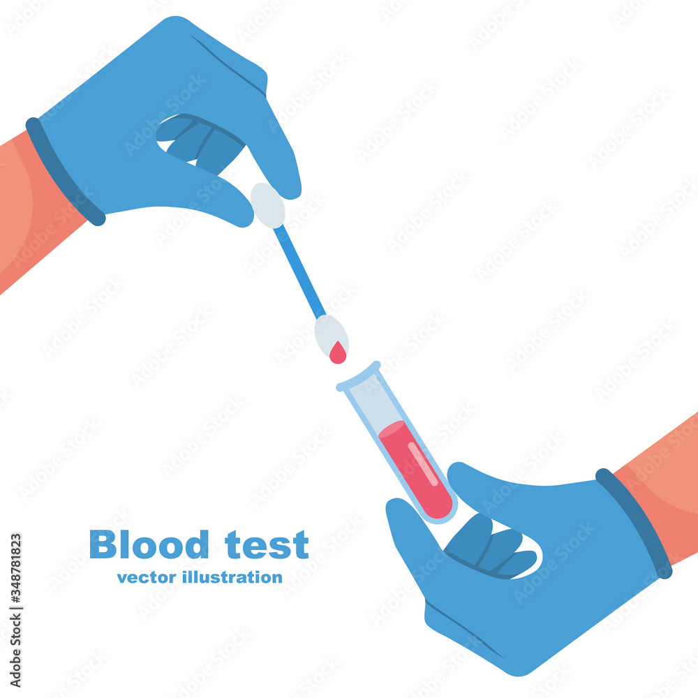 Doctor hold in hand sample blood in test tube. Laboratory research ...