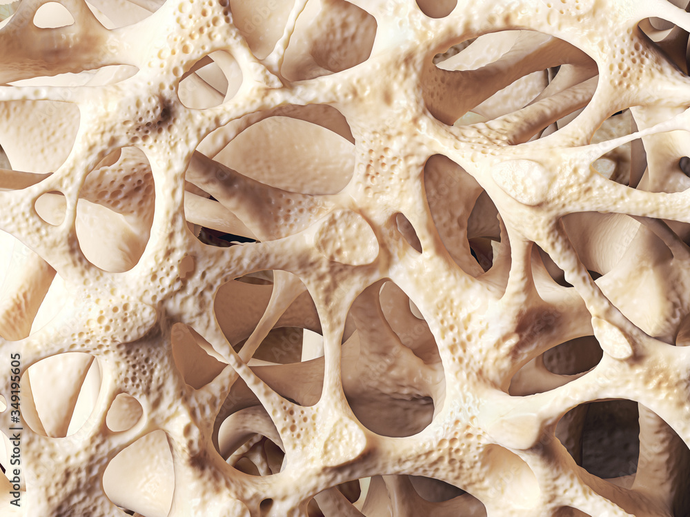 Realistic bone spongy structure close-up, bone texture affected by ...
