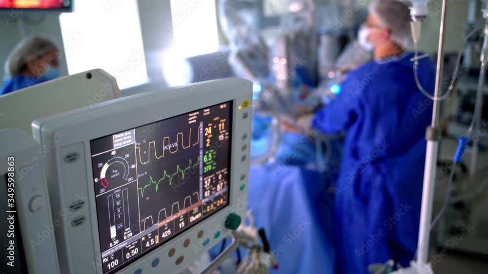 Monitor shows the patient's condition during surgery. Modern medical ...