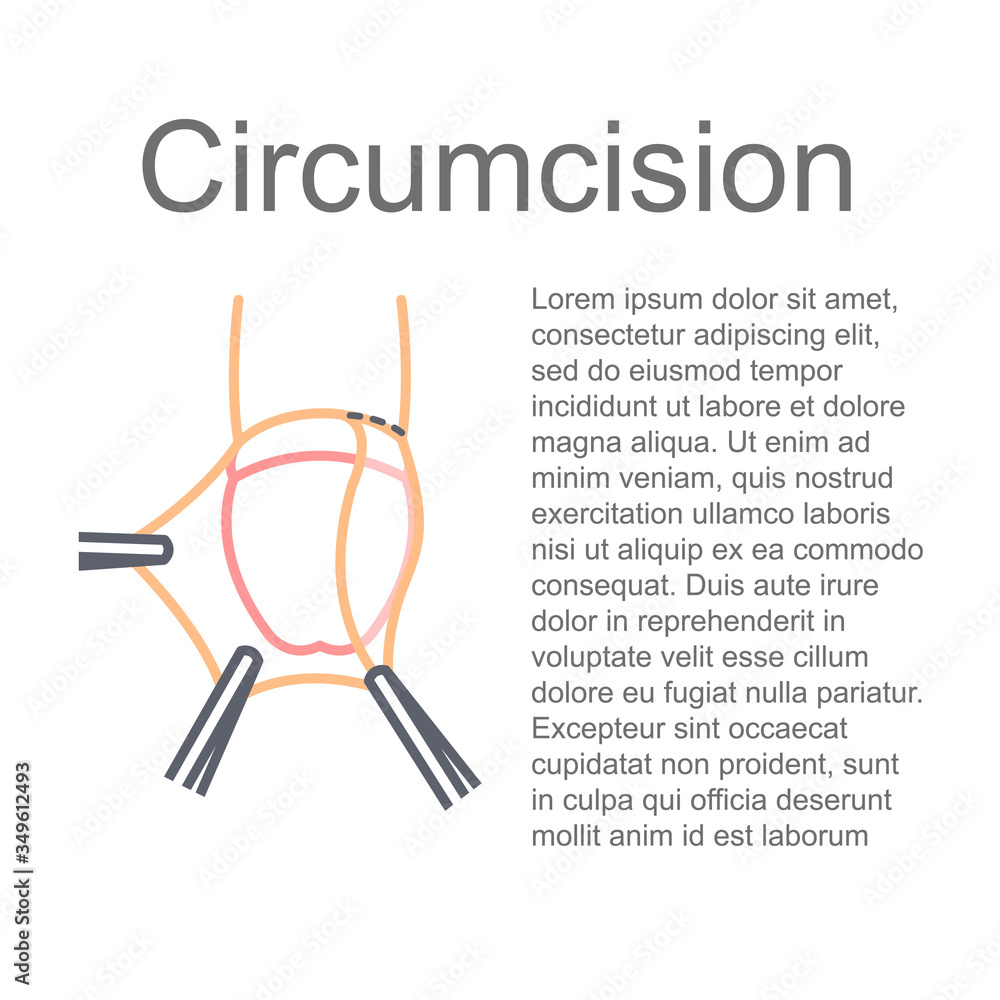 circumcision line icon, vector illustration Stock Vector | Adobe Stock