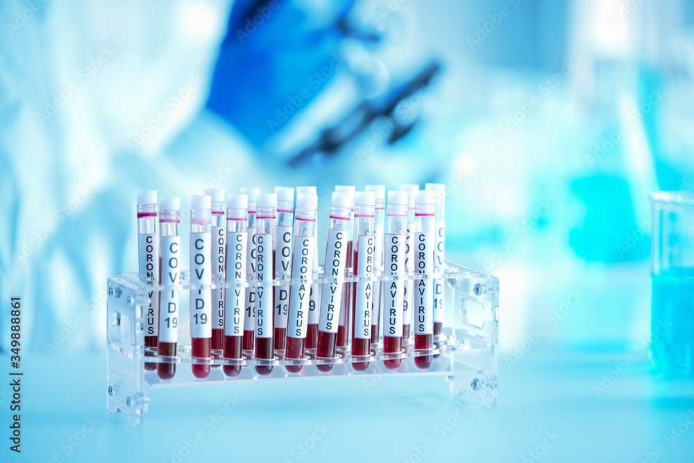 Image LAB of Coronavirus covid-19 sample test with microscope by ...