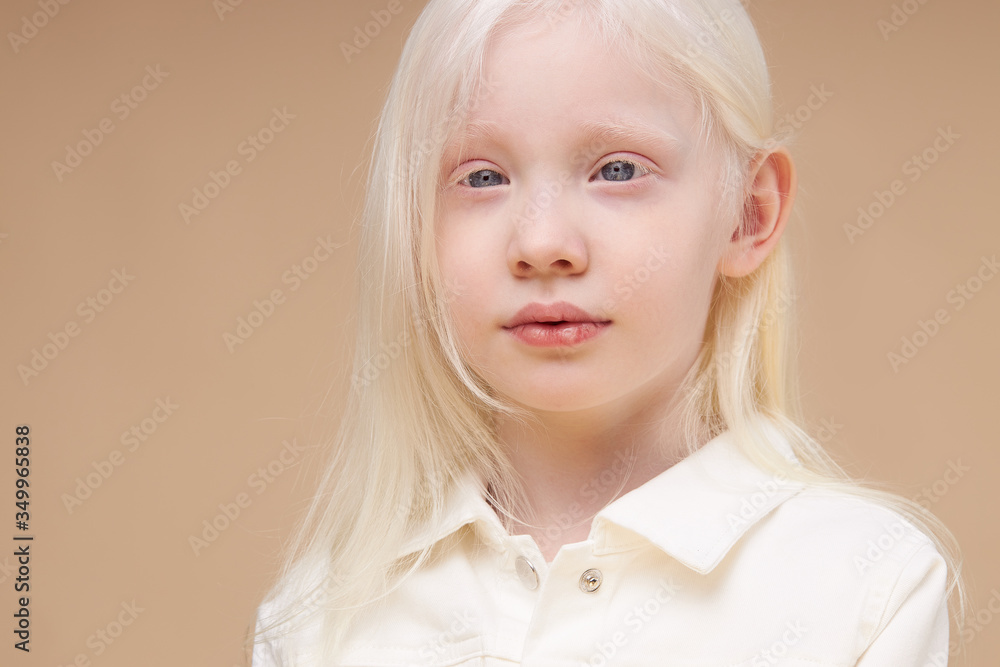 portrait of albino kid girl with white skin and white hair. Blonde girl ...