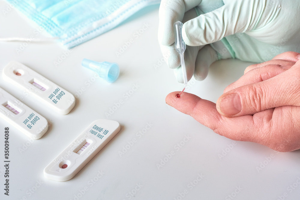 Rapid COVID-19 test for detection of specific antibodies IgM and IgG to ...