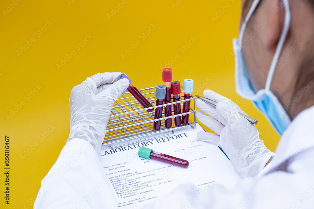 Professional doctors perform COVID-19 tests from samples of blood tests ...