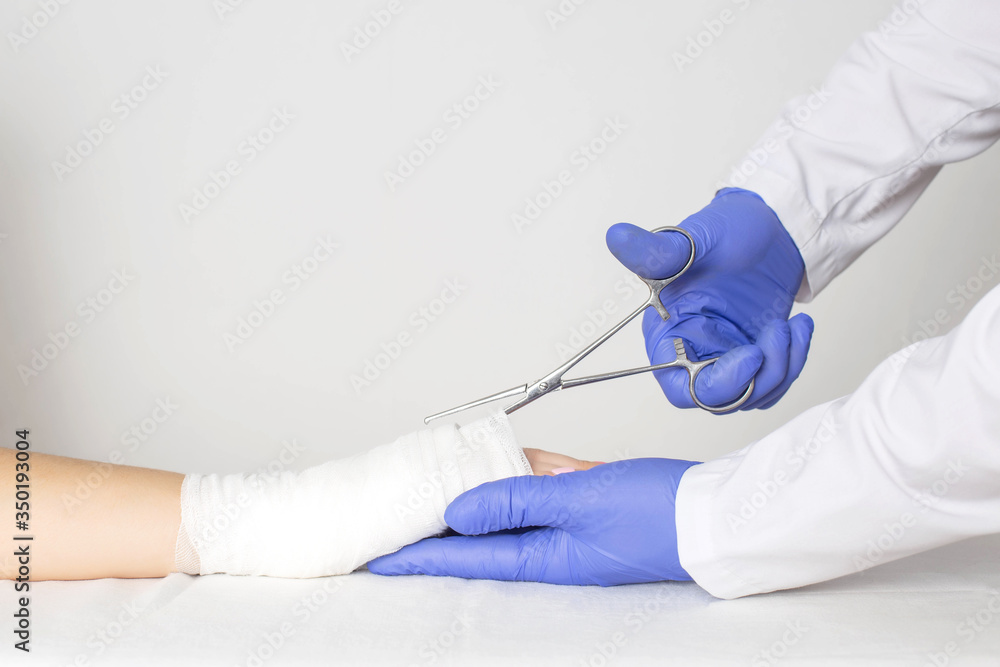 An orthopedic doctor removes plaster from bandages in the palm of a ...