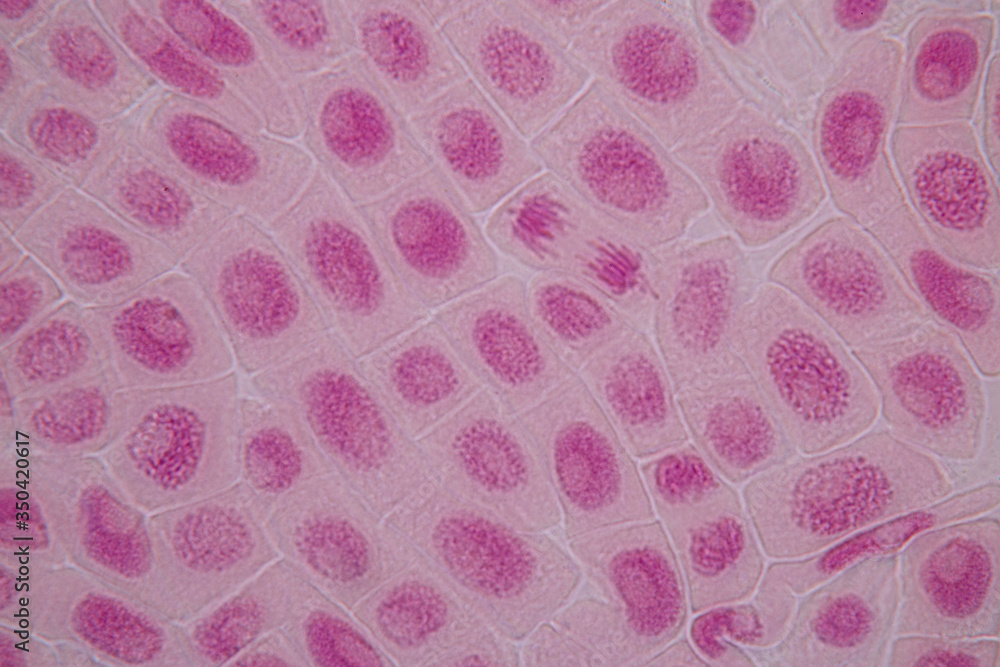 Root tip of Onion and Mitosis cell in the Root tip of Onion under a ...