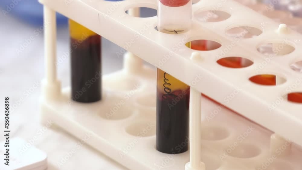 Test Tube Rack with Test Coronavirus Tubes. Laboratory interior, test ...