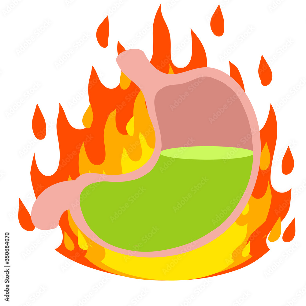 Digestive problems. Heartburn in stomach. Medical care. Indigestion in ...