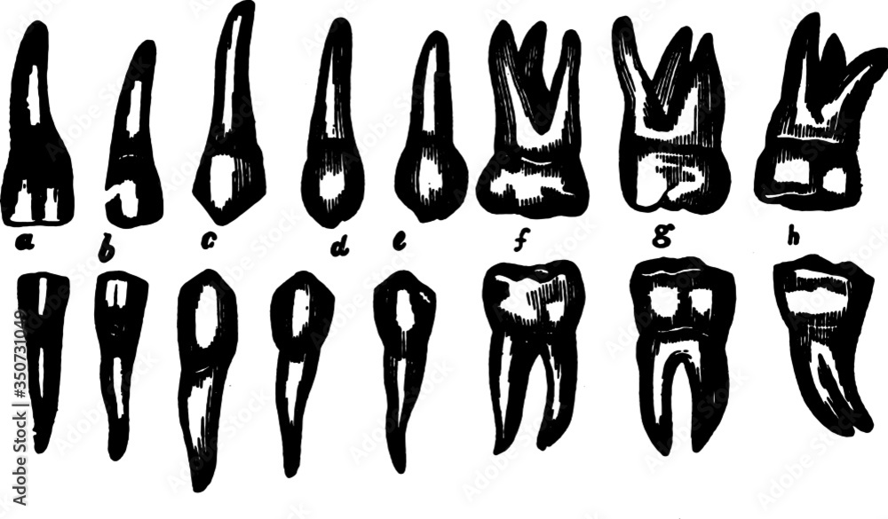 Tooth Diagram Vector Stock Vector | Adobe Stock