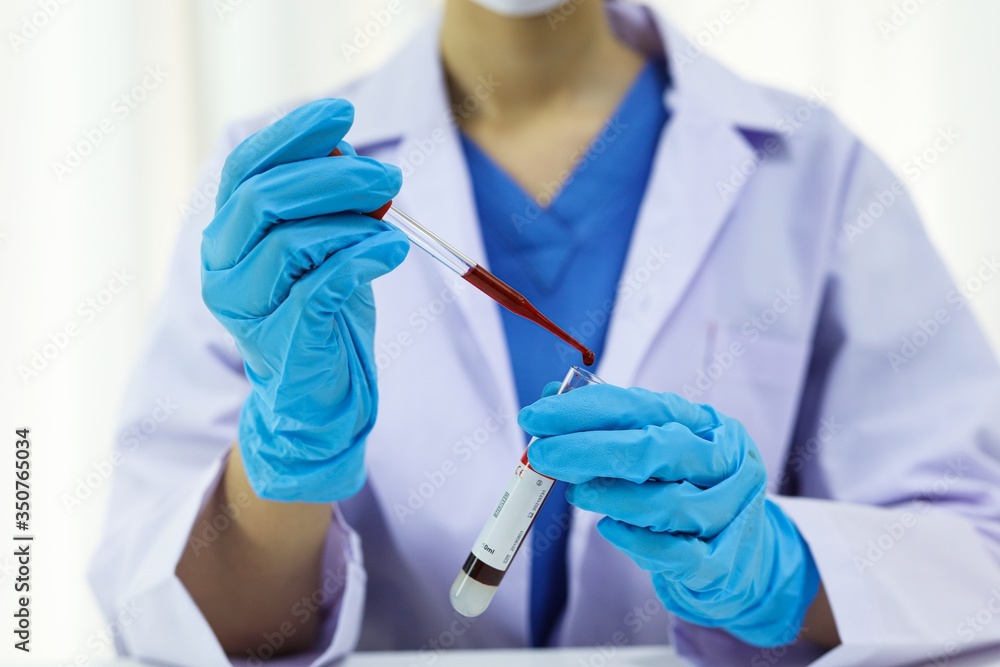 Scientist holding Coronavirus covid-19 infected blood sample tube DNA ...