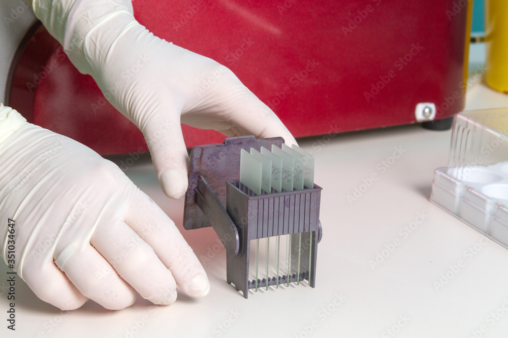 Histology test lab in hospital. Hands in gloves, tech loads slide ...