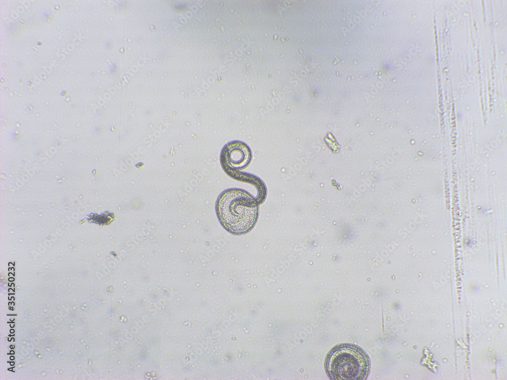 Toxocara canis second stage larvae hatch from eggs Stock Photo | Adobe ...