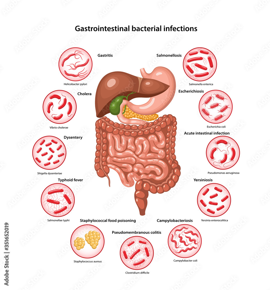 Page template with image of digestive system and bacteria that cause ...