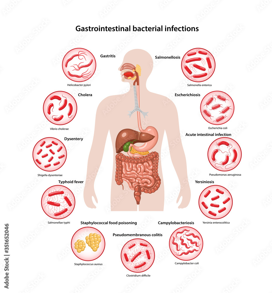 Naklejka Page template with image of human body and bacteria that cause ...