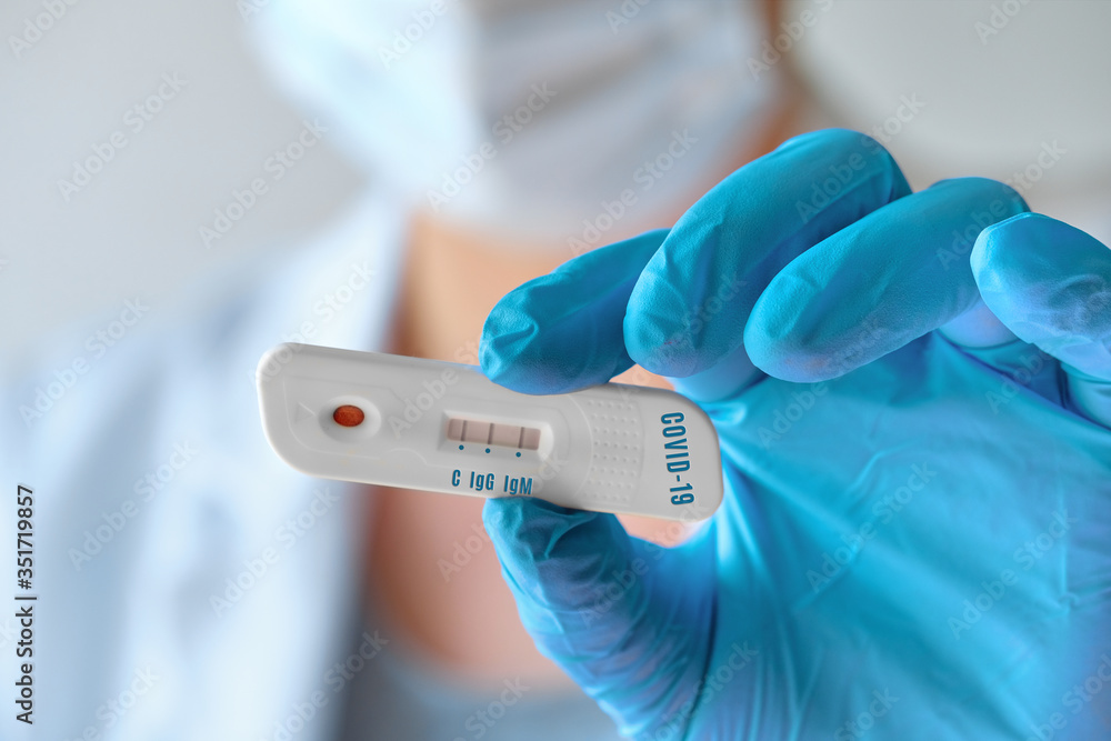 Doctor or medtech shows rapid laboratory COVID-19 test to detect IgM ... Doctor or medtech shows rapid laboratory COVID-19 test to detect IgM ...