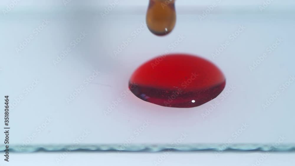 Blood test in the laboratory. Lab technician drops reagent on a drop of ...