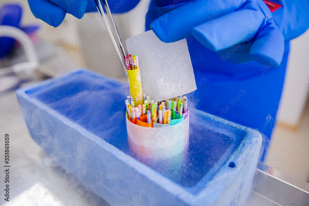 In vitro fertilization human egg cells liquid nitrogen cryo ...