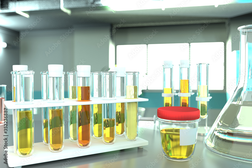laboratory test tubes in modern chemical clinic - urine quality test ...