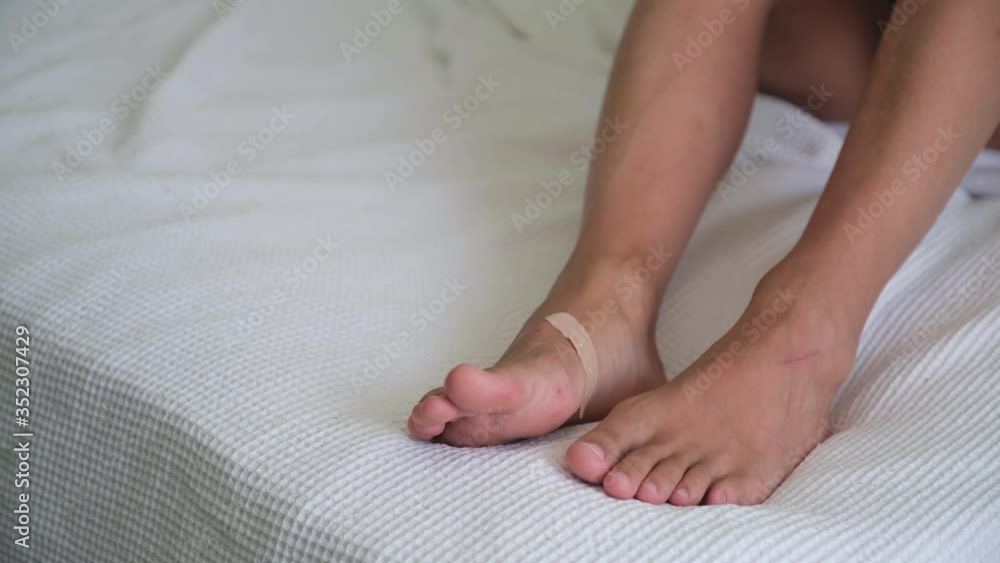 Close up tanned female bare feet on bed. Foot in scratches. A young ...